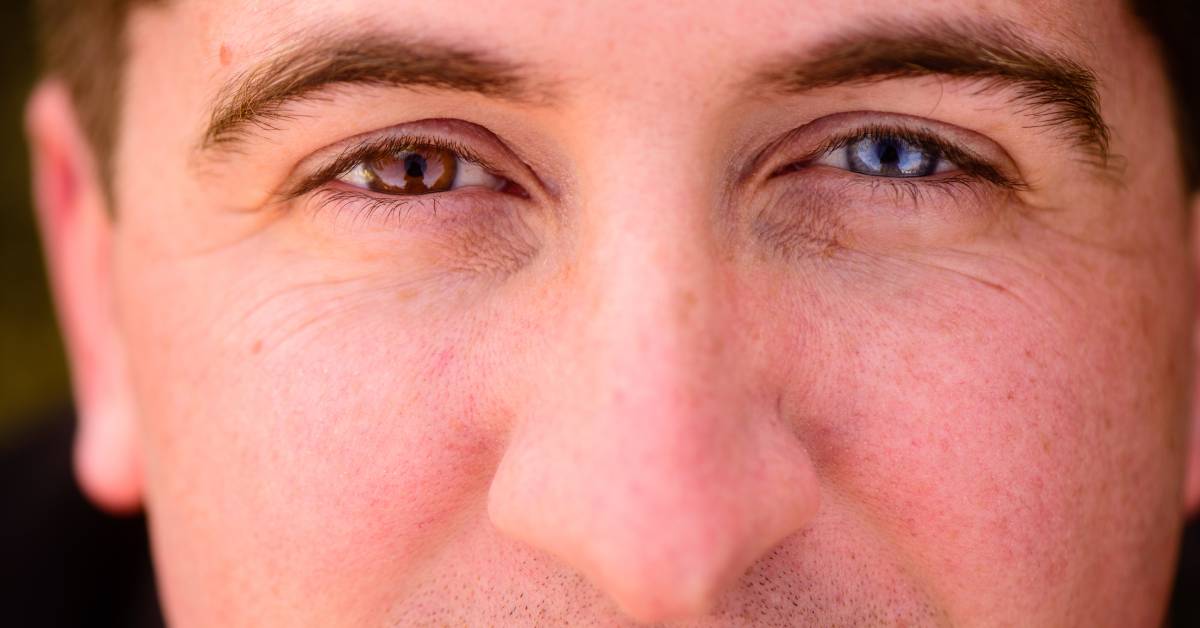 Heterochromie: Příčiny, Symptomy a Léčba • Senior Hub [year]